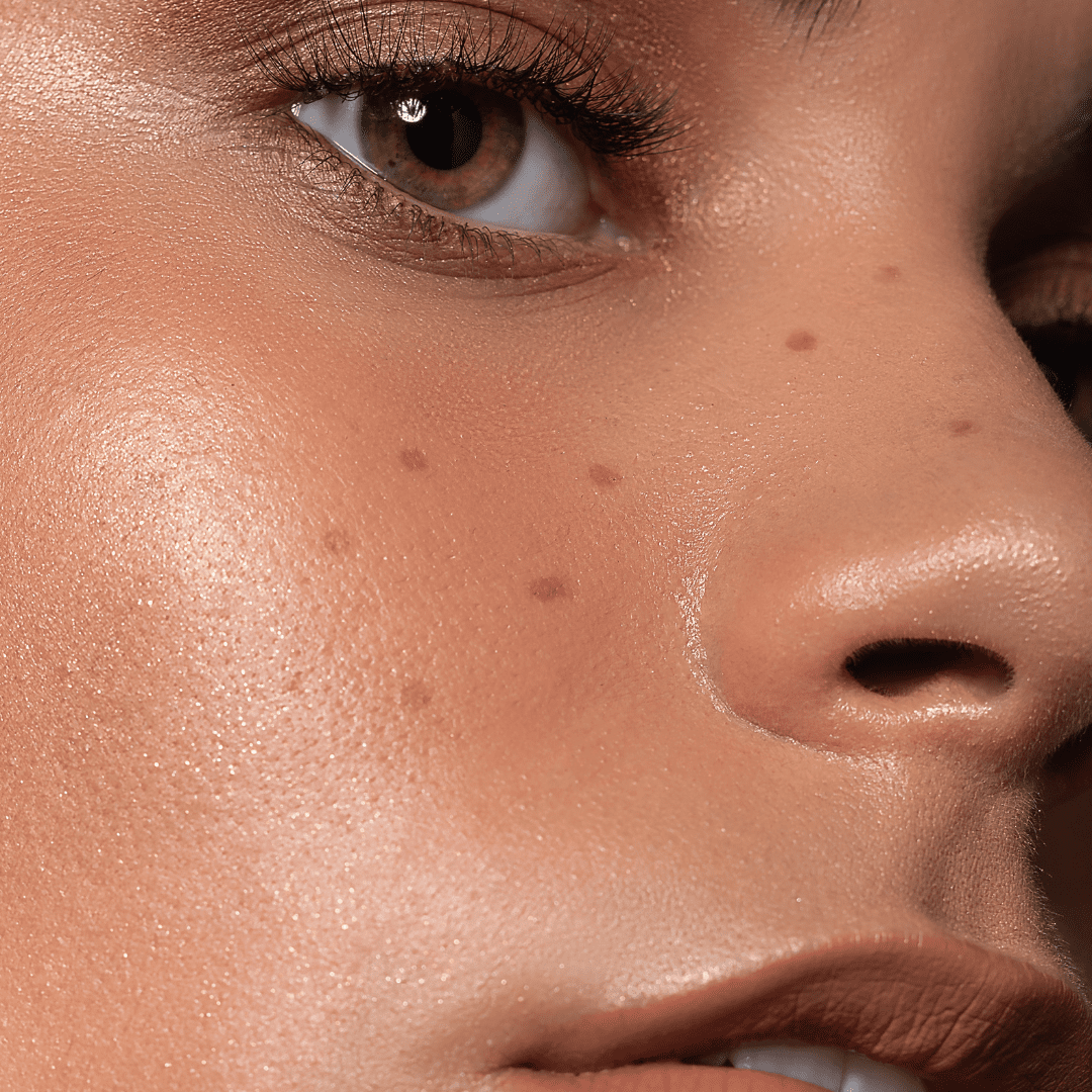 Ray Aesthetics: Your Destination for Youthful Skin